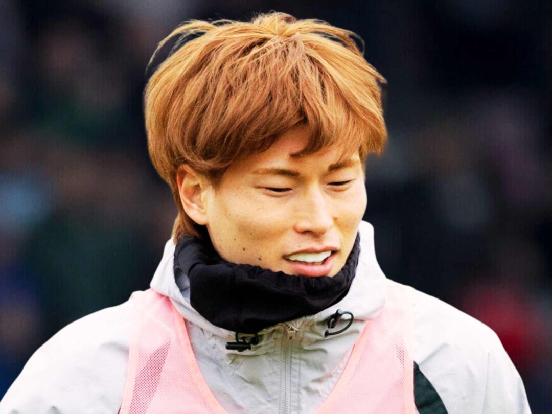 Has Celtic Star Kyogo Furuhashi Gotten New Teeth? Here’s What We Know ...