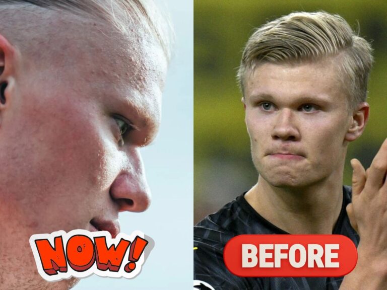 Real Reason Fans Think Erling Haaland is Ruining His Hairline – Thick ...
