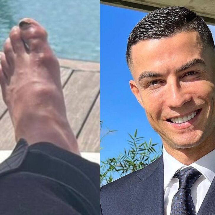 Fans Shocked by Cristiano Ronaldo’s Wartorn Feet in New Snap – Thick Accent